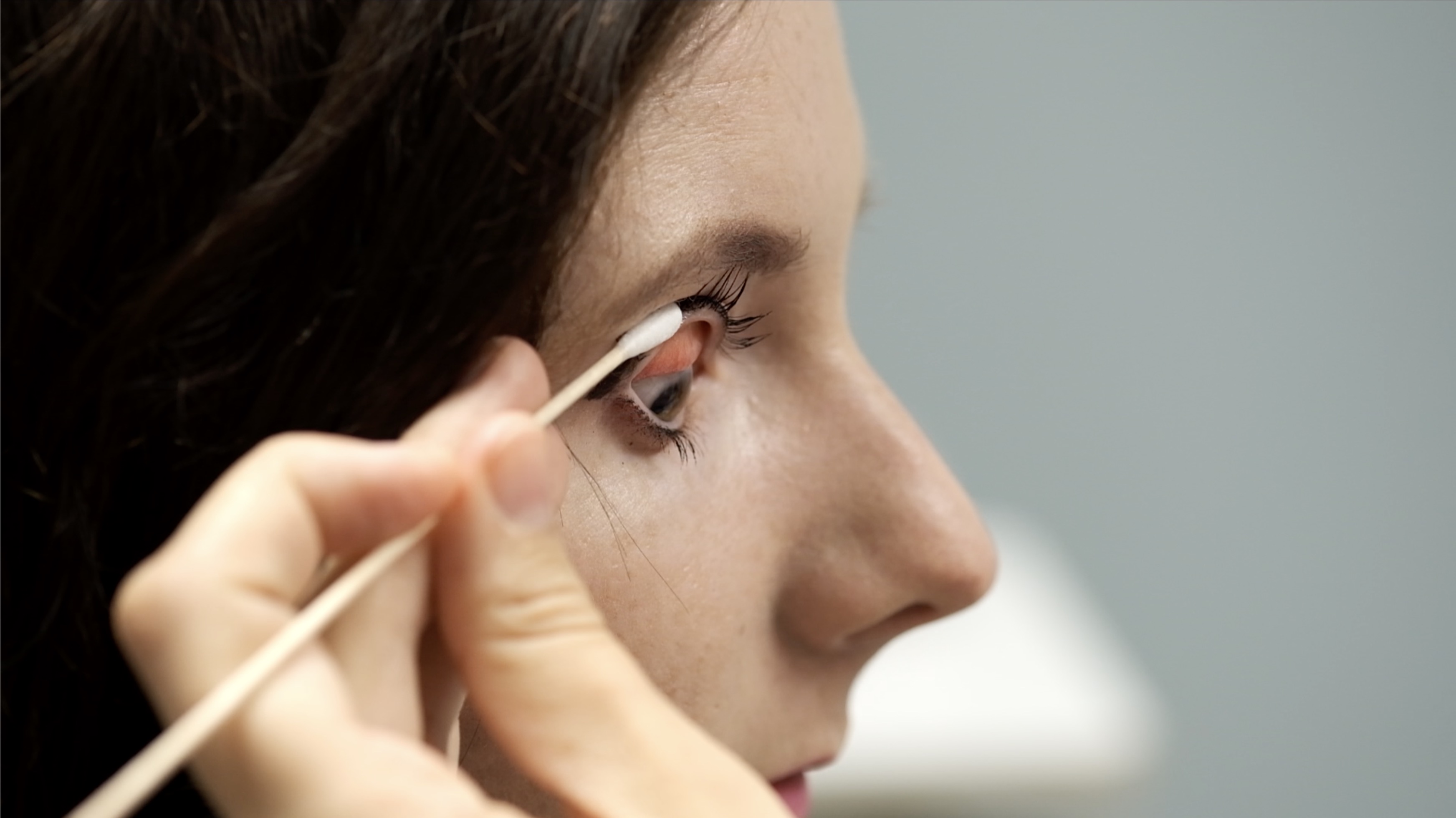 Emergency Skills | Department of Ophthalmology | School of Medicine ...