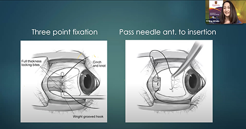 The Wright Webinars | Department of Ophthalmology | School of Medicine ...