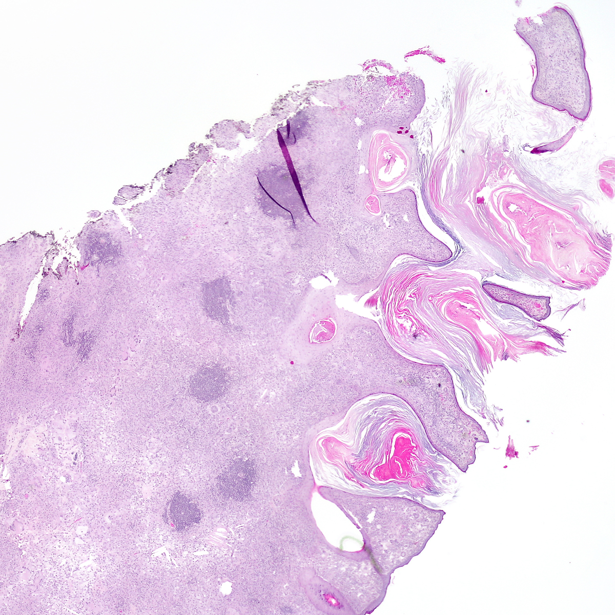 Clinical Services | Department of Ophthalmology | School of Medicine ...